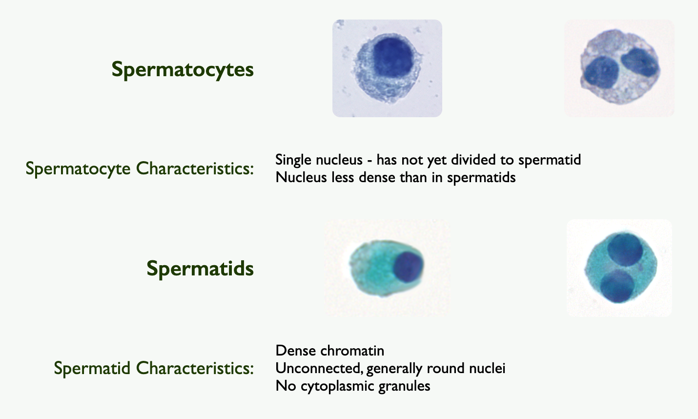Article Round Cells In Semen article-round-cells-in-semen